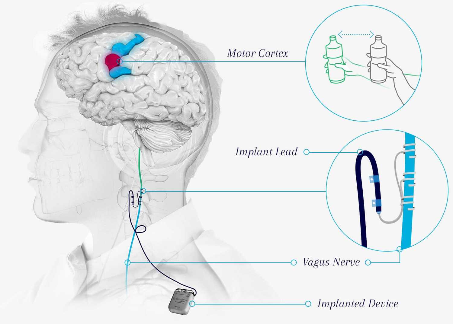 Going Long on the Vagus nerve: Startups Re-discover the Autonomic ...