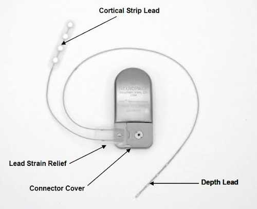 Closed Loop Brain Computer Interfaces From The Interface